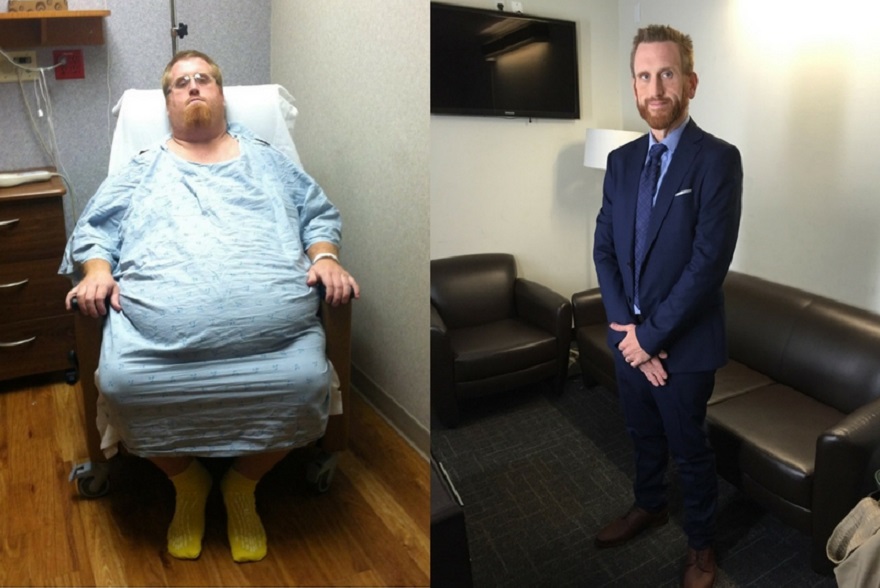 ‘I knew I was going to die.’: 500-pound man loses a whopping 350 pounds ...