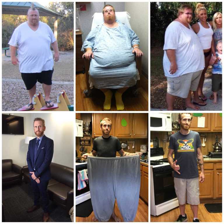 ‘I knew I was going to die.’: 500-pound man loses a whopping 350 pounds ...