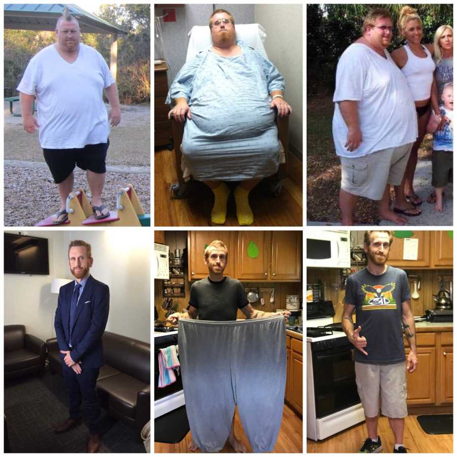 ‘I knew I was going to die.’: 500-pound man loses a whopping 350 pounds ...