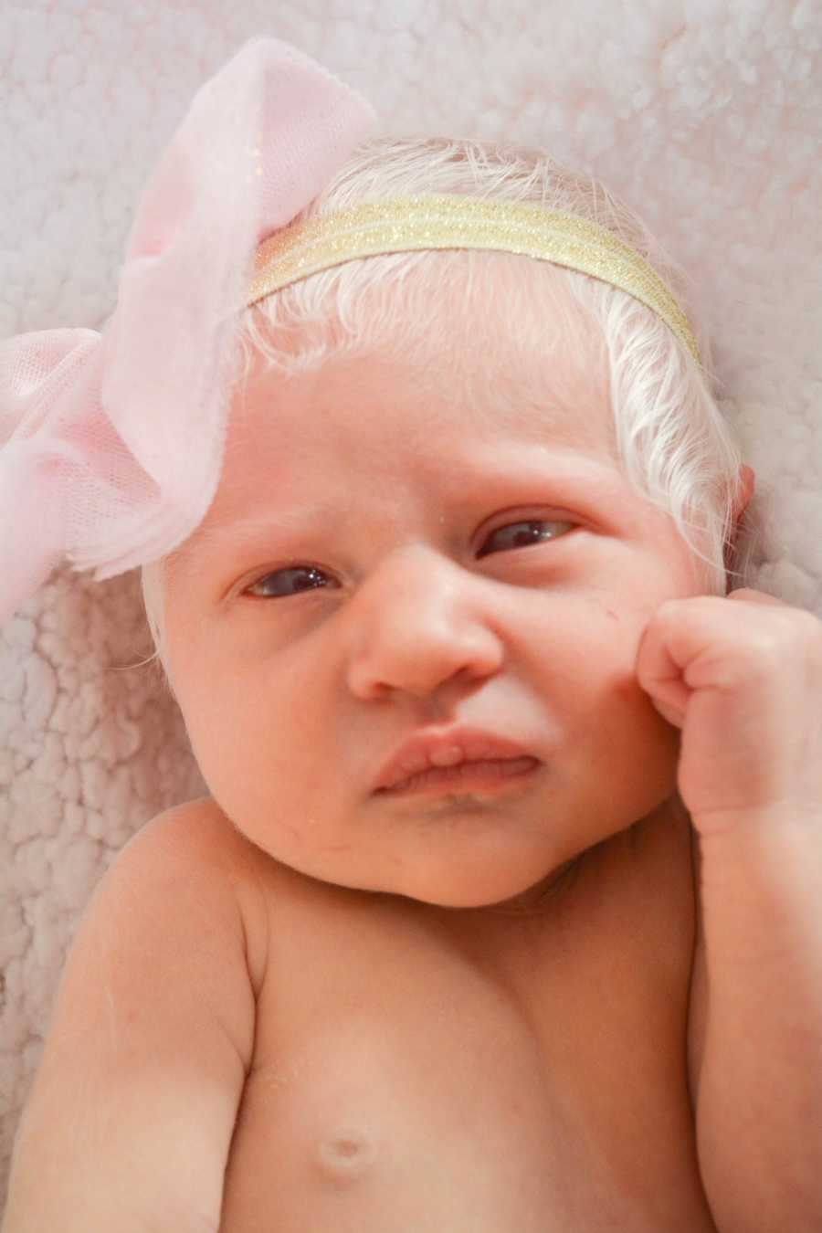 ‘Our baby had a head full of hair — WHITE AS SNOW.’: Mom’s shocked ...
