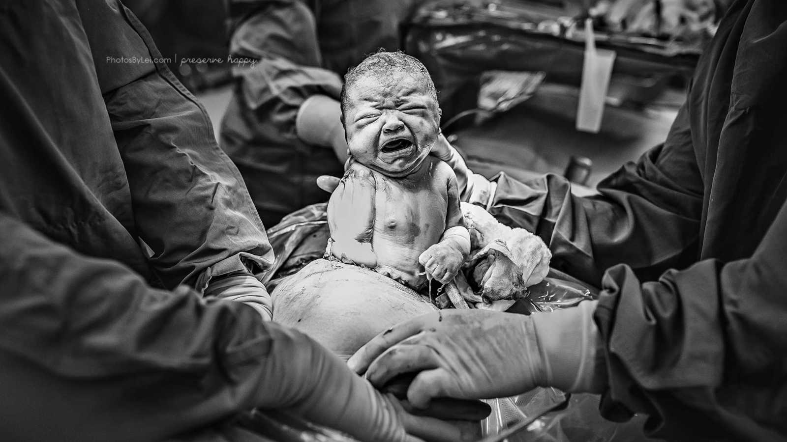 ‘This too is beautiful. This too is a miracle.’: Birth photographer ...