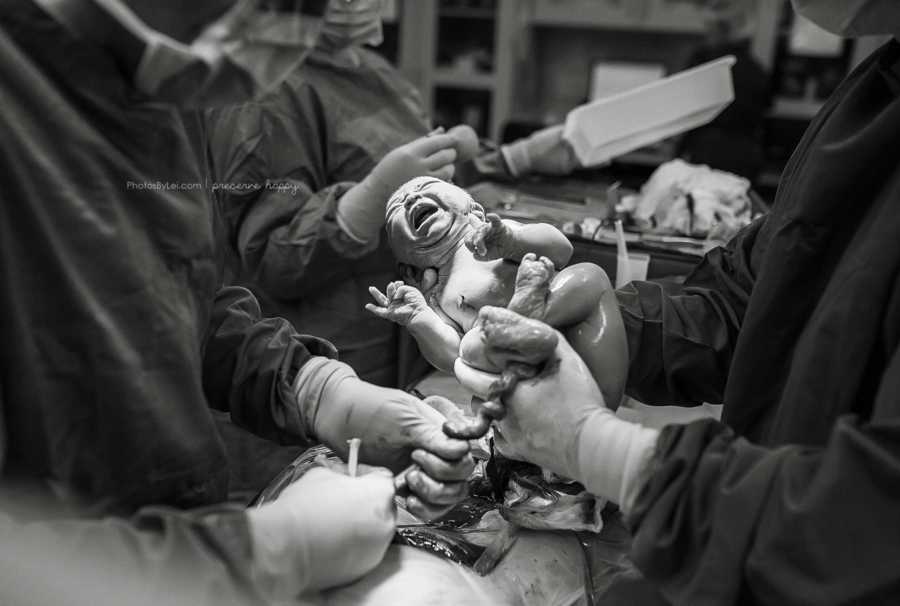 ‘This too is beautiful. This too is a miracle.’: Birth photographer ...
