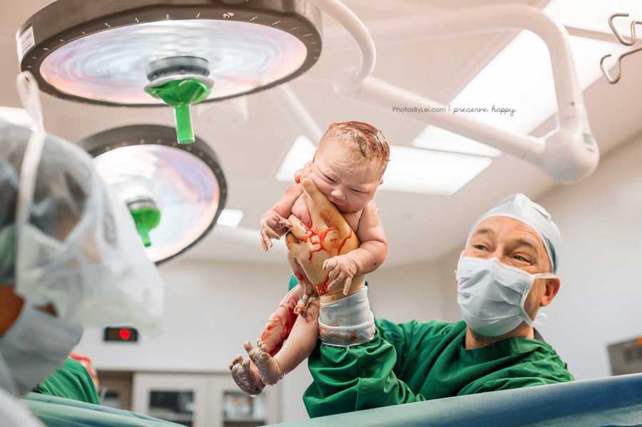 ‘This too is beautiful. This too is a miracle.’: Birth photographer ...