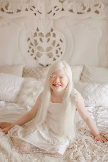 ‘Life with four children with albinism has been quite the adventure ...