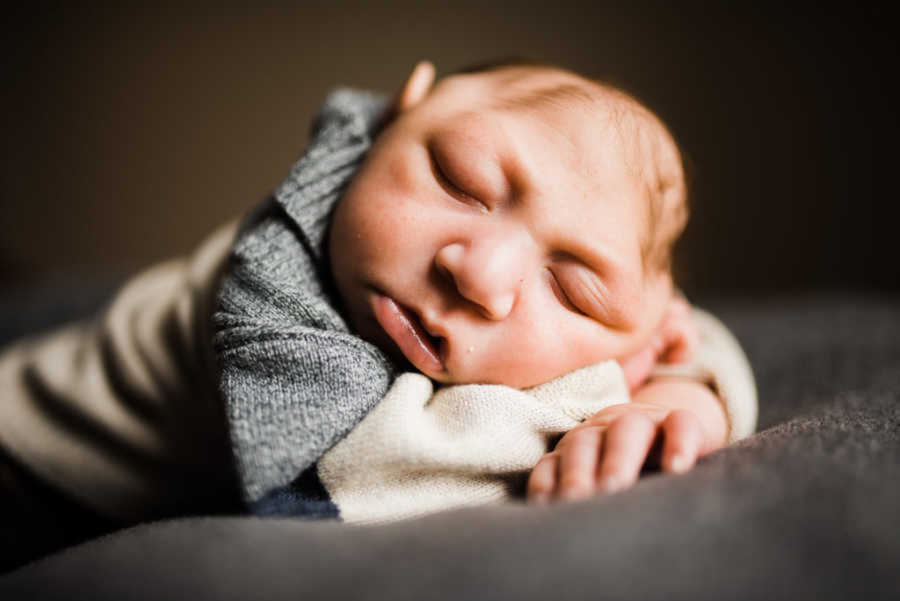 I Photographed This Newborn With Microcephaly A Day Before He Died, And ...
