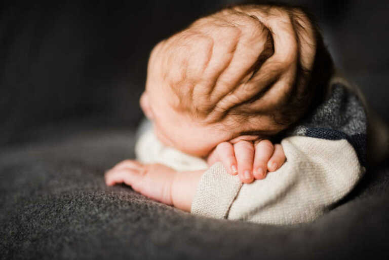 I Photographed This Newborn With Microcephaly A Day Before He Died, And ...