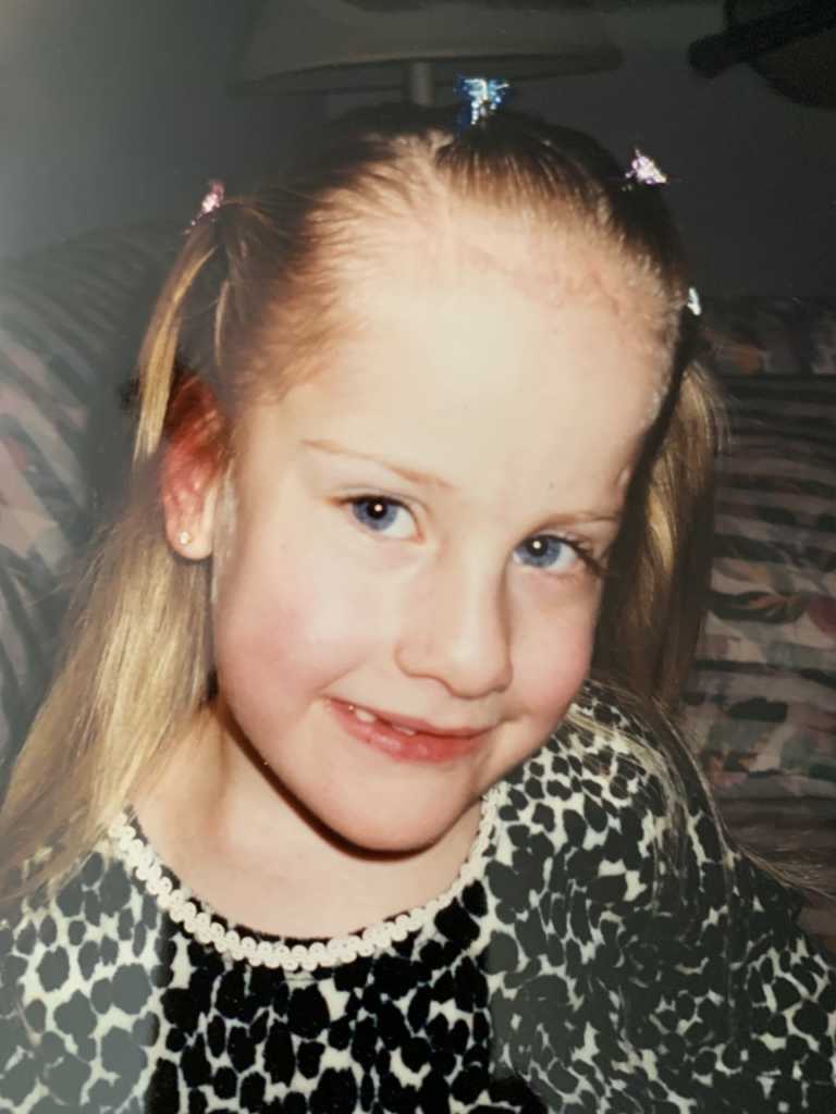 ‘There’s something wrong with her!’ My mom looked at my triangular ...