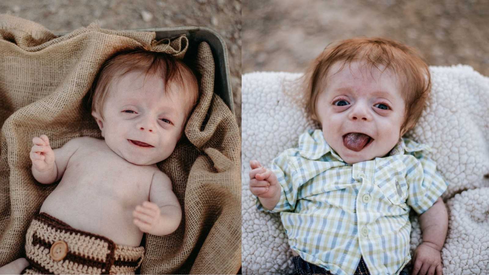 ‘He is broken and breaking,’ the doctors said. ‘No hope. Always fatal ...