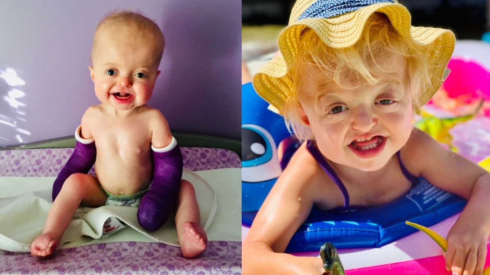 ‘What’s wrong with her fingers?,’ my husband asked. ‘They look strange ...