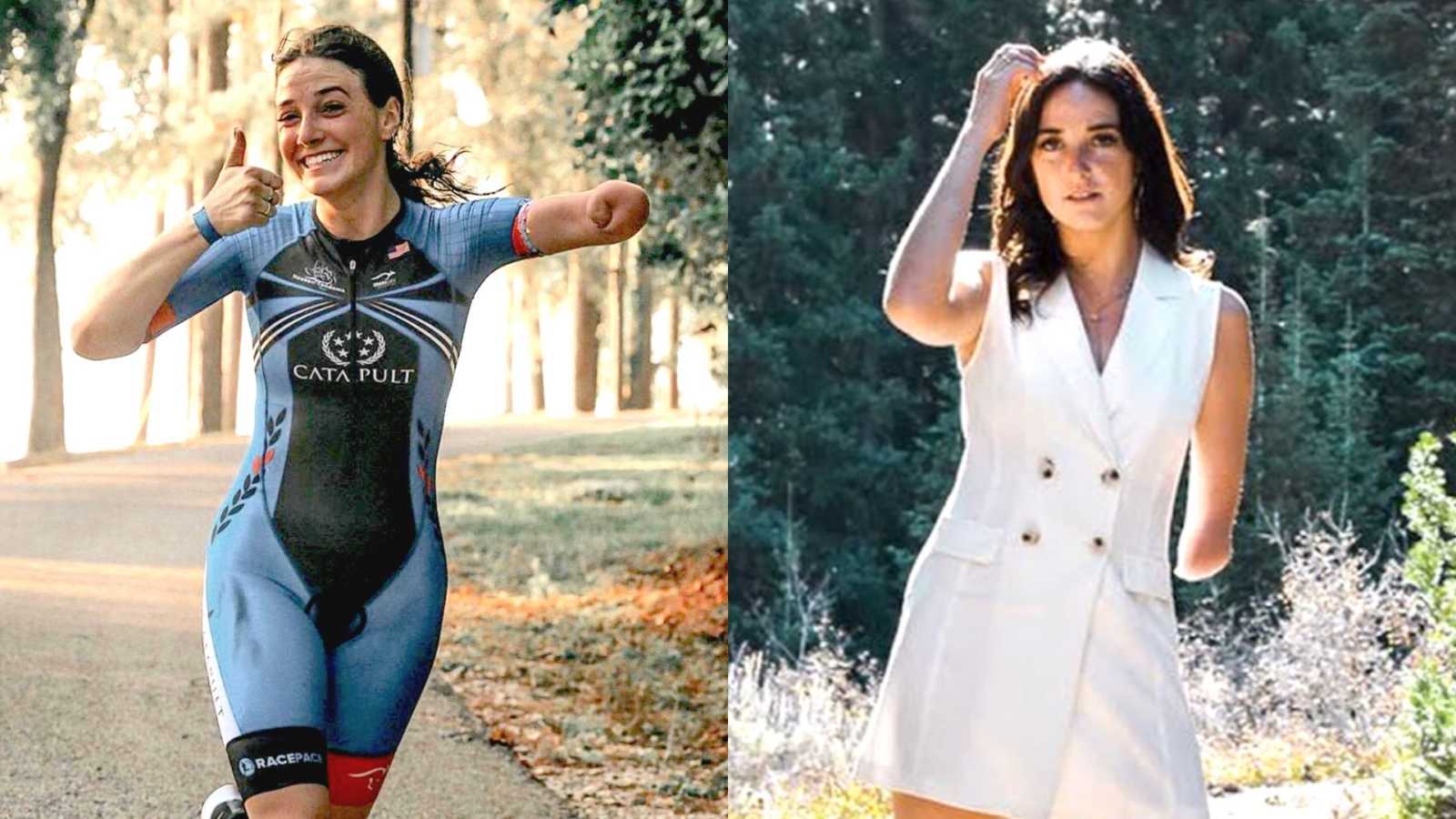 ‘How dare she take away my unique quality?’ I was the ‘girl with one ...