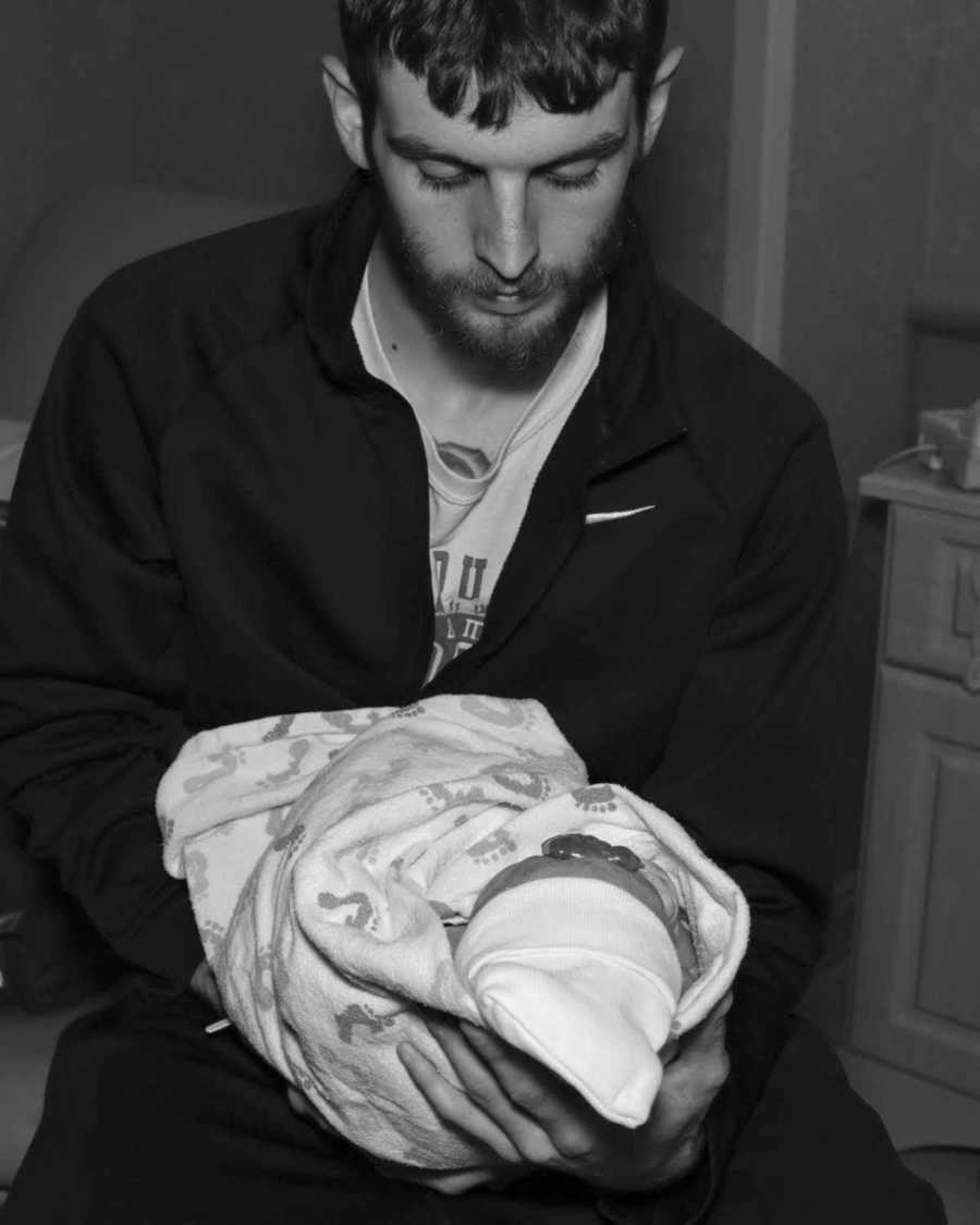 My Baby Was Born Without Most Of His Skull: The Journey Of A ...