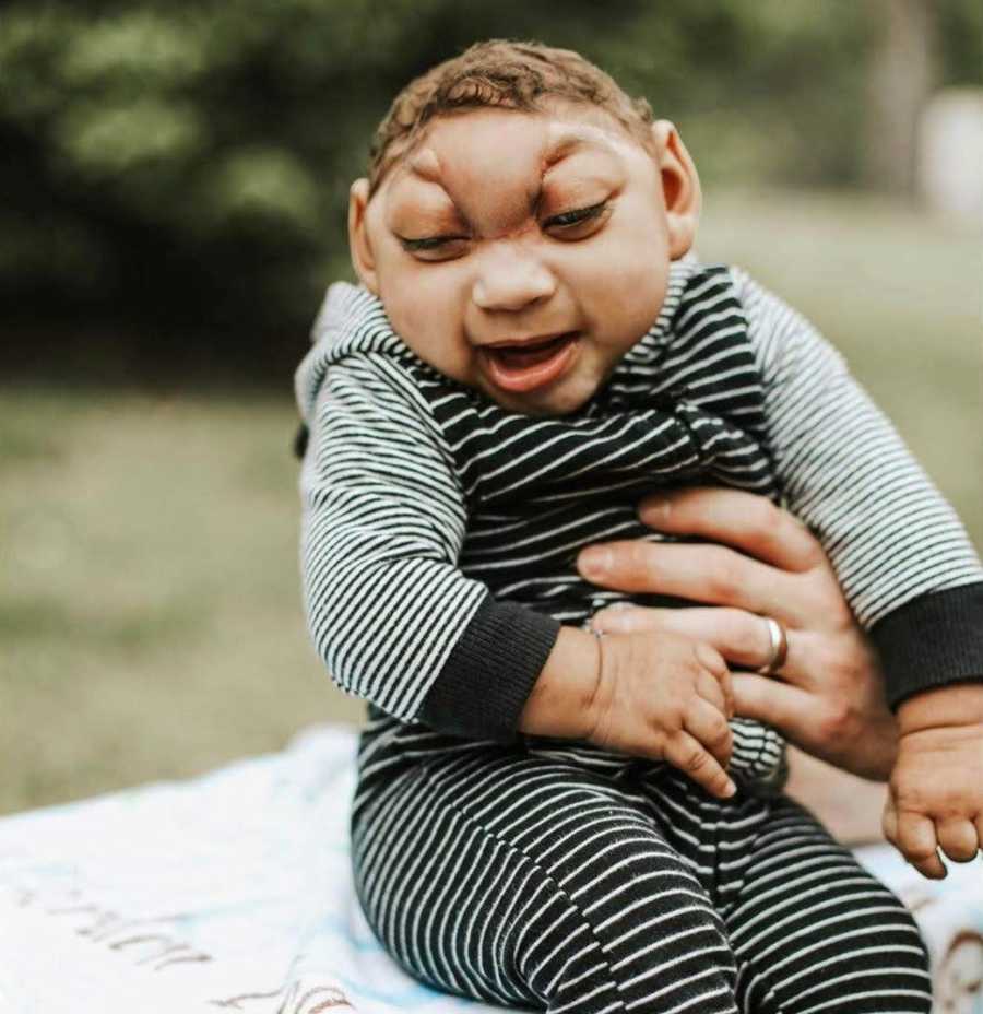 My Baby Was Born Without Most Of His Skull: The Journey Of A ...