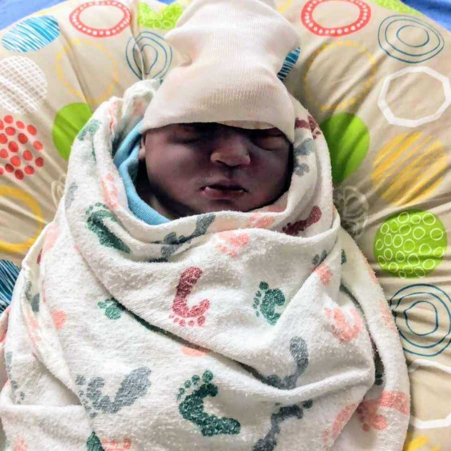 My Baby Was Born Without Most Of His Skull: The Journey Of A ...