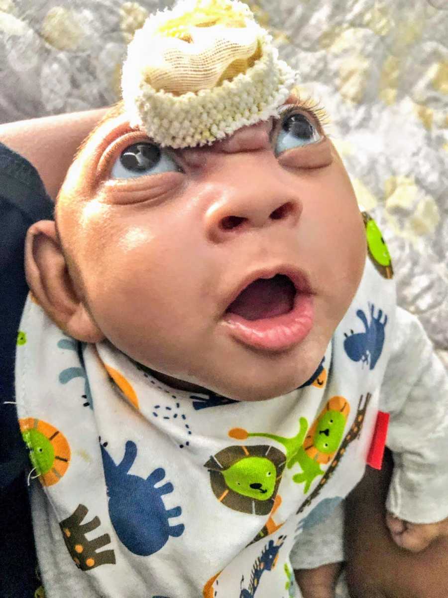 My Baby Was Born Without Most Of His Skull: The Journey Of A ...