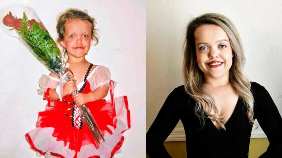 ‘What’s it like being a little person?’ I was touched without my ...