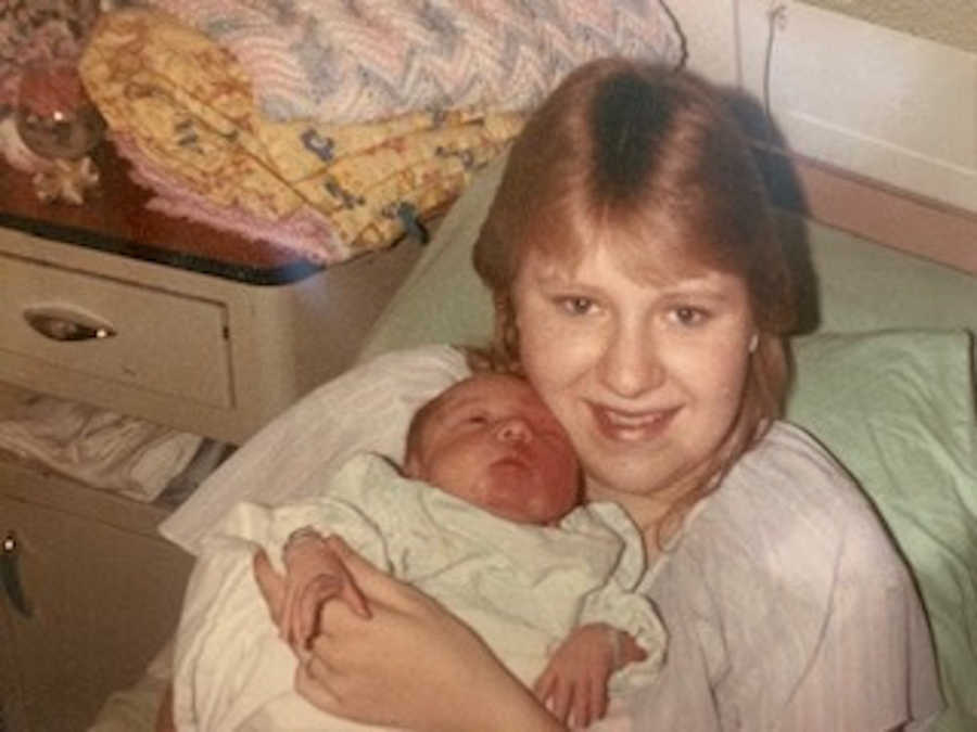 I Have A Facial Difference Called Sturge Weber Syndrome, And No I’m Not ...