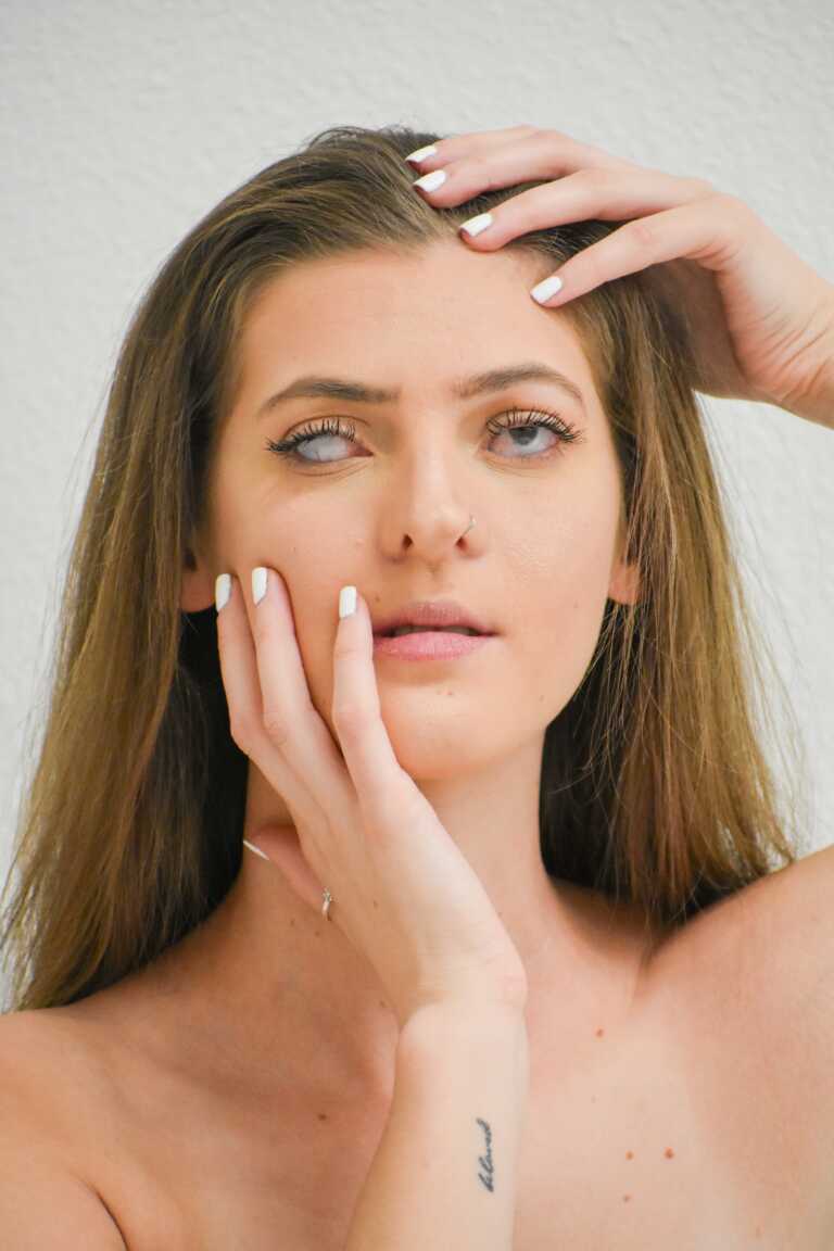 I Have A Rare Genetic Disorder Called Oculofaciocardiodental Syndrome ...