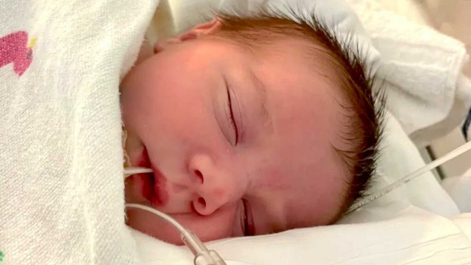 ‘Your baby has a birth defect.’ The beautiful boy with the pouty little ...