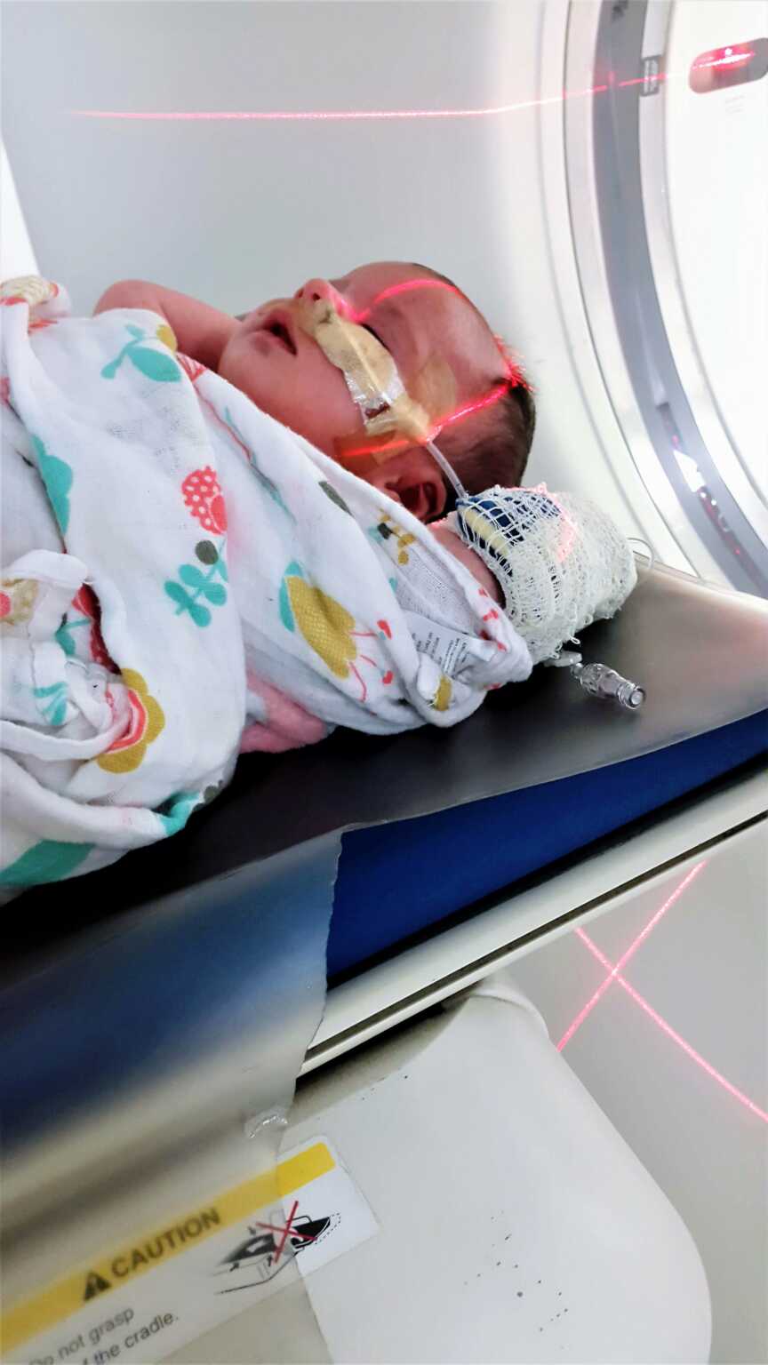 A Look Inside 16q11.2q 21 Duplication: The Rare Disease Affecting Only ...