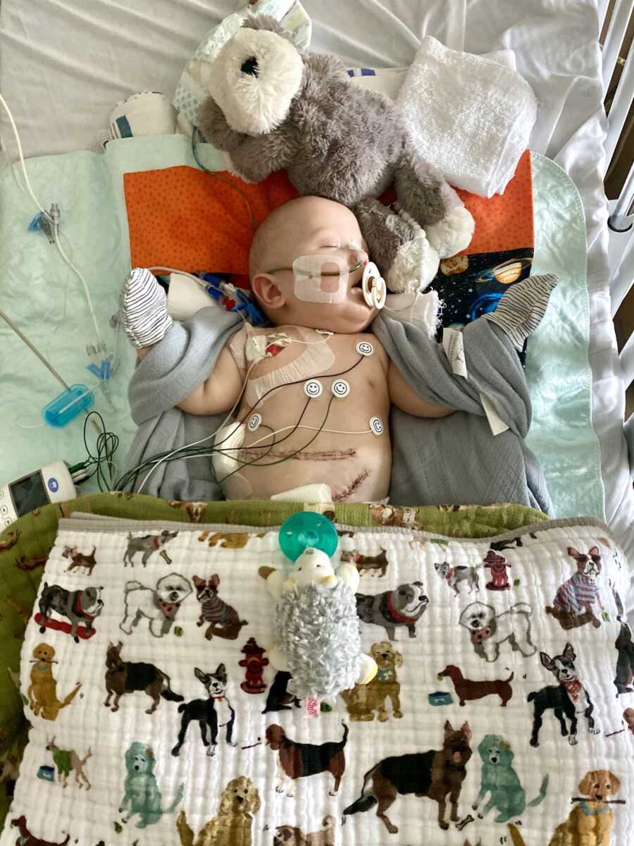After 113 Days In NICU, 1-Pound Preemie Defies All Odds To Become ...