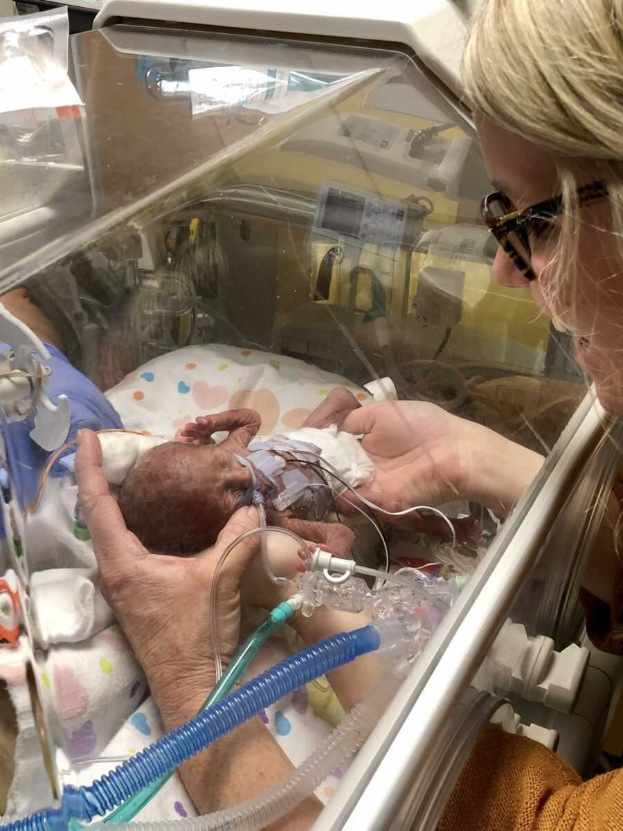 After 113 Days In NICU, 1-Pound Preemie Defies All Odds To Become ...