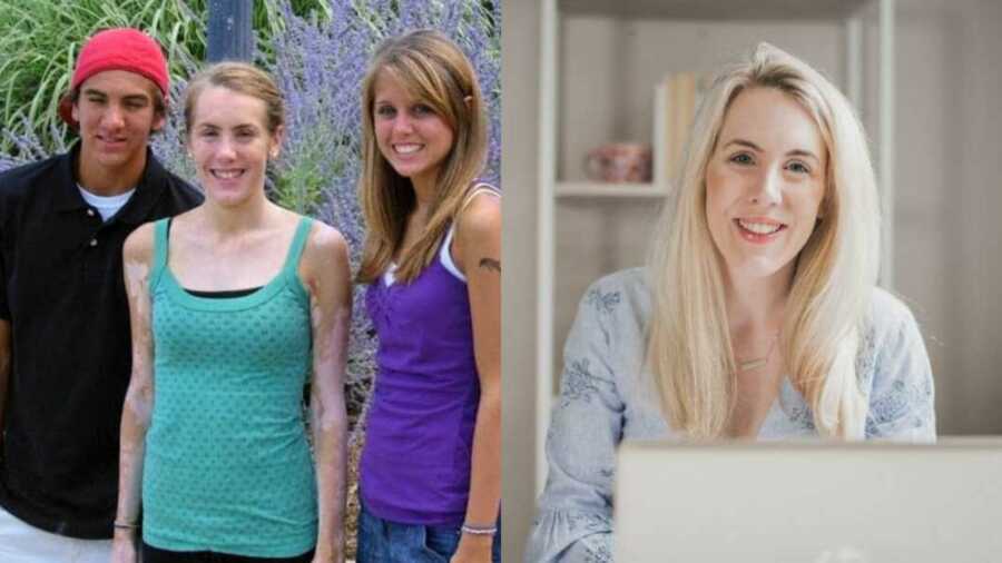 ‘I turned to tanner to ‘get back’ the skin I felt I’d lost.’: Woman ...