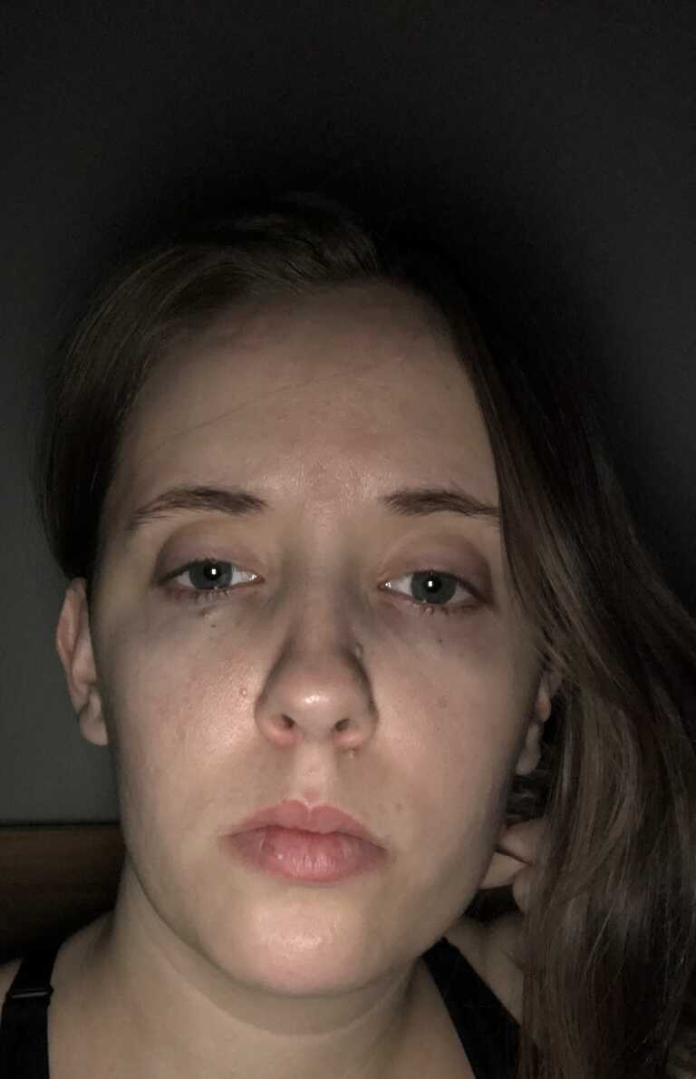 I Had So Many Plans For My Life I m Only In My 20s Lyme Warrior s i-had-so-many-plans-for-my-life-i-m-only-in-my-20s-lyme-warrior-s